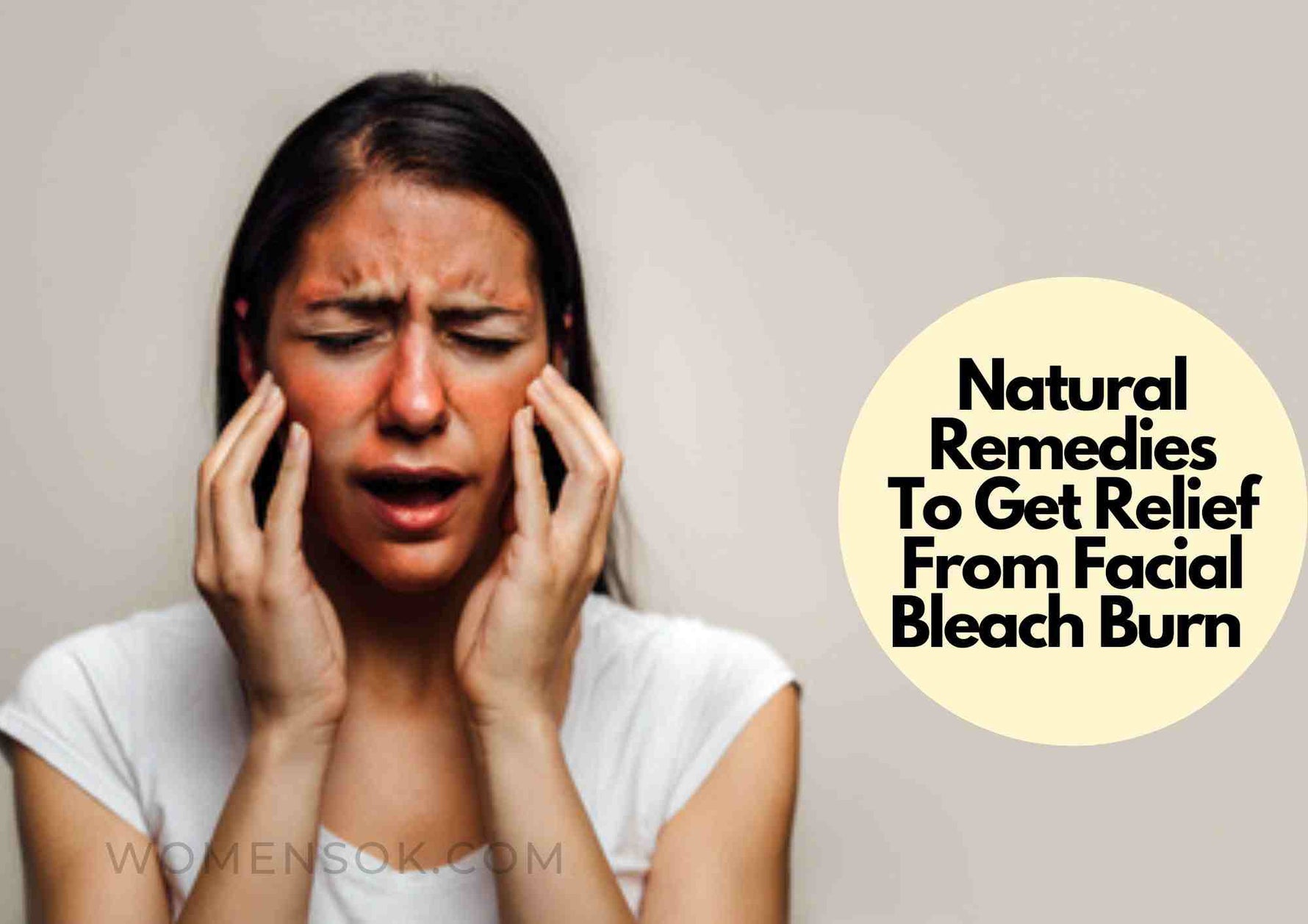 8 Natural Remedies To Get Relief From Facial Bleach Burn | Soothing Ti